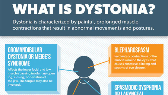 Talking to Jennifer Burns About Focal Dystonia